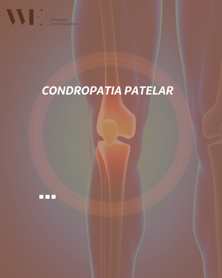 Condropatia Patelar – We